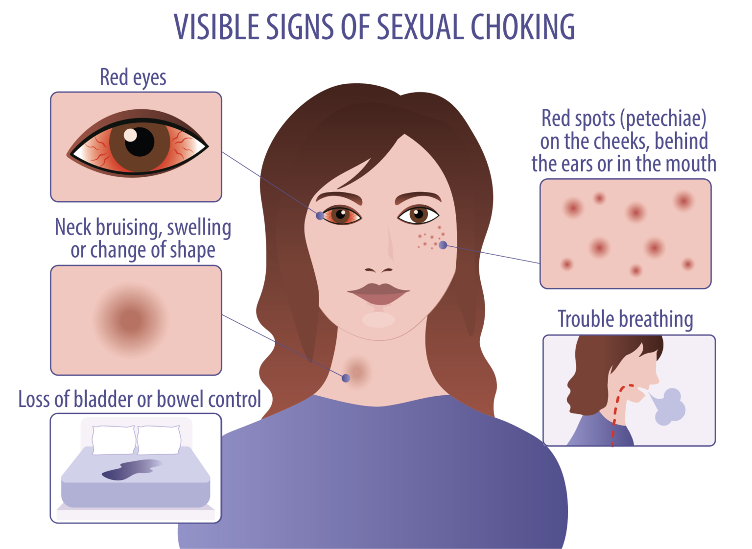 Sexual choking - It Left No Marks