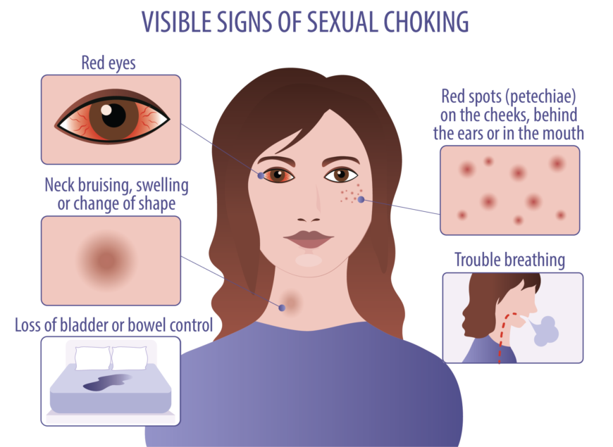 Sexual choking - It Left No Marks