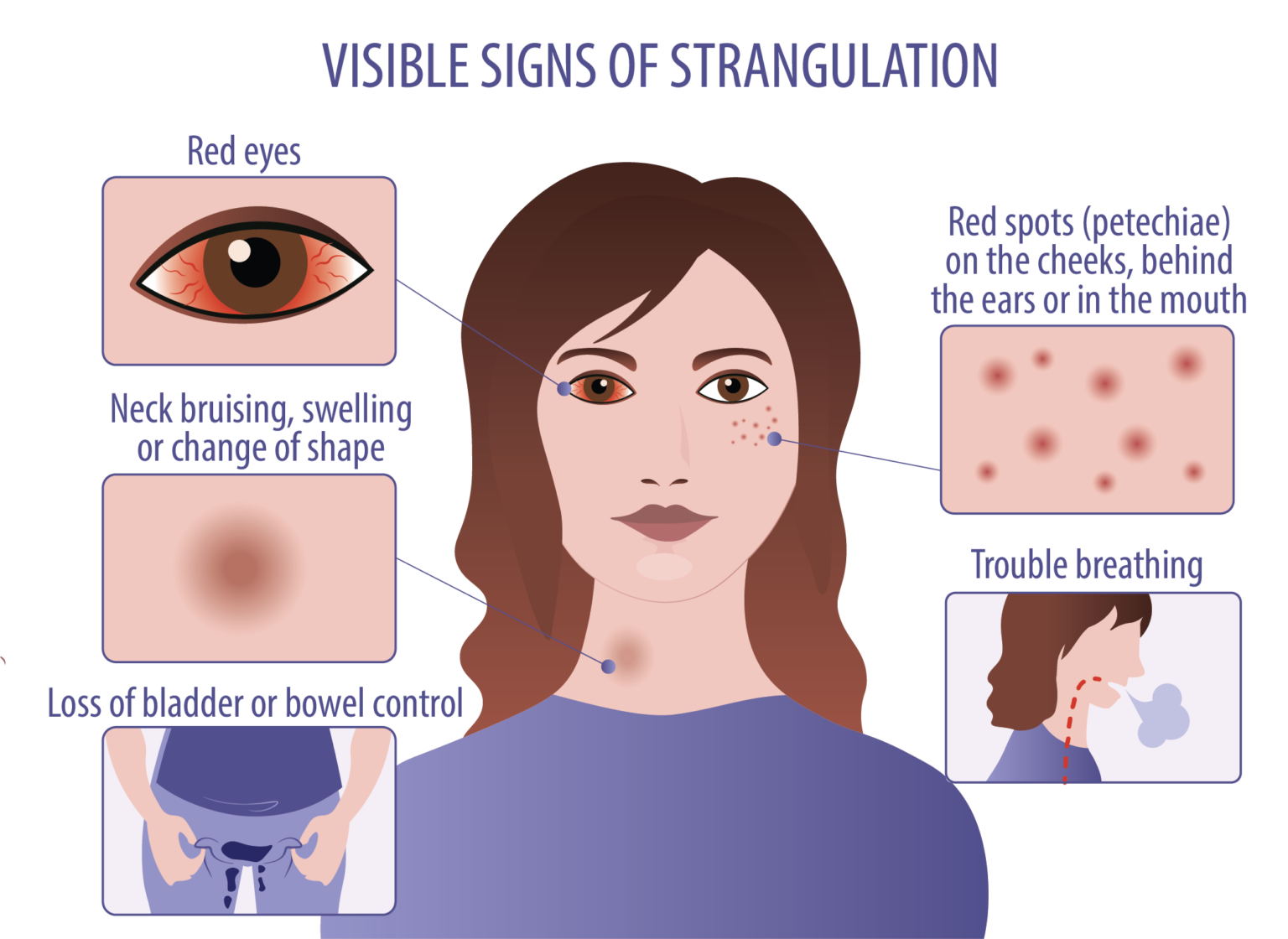 Strangulation - It Left No Marks
