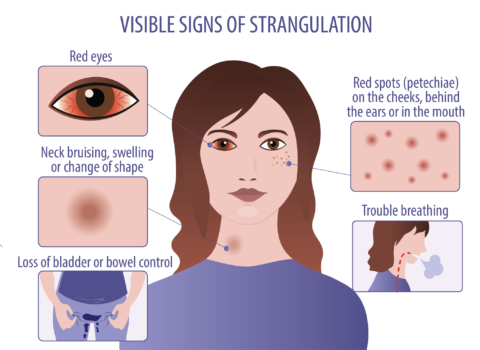 Strangulation - It Left No Marks