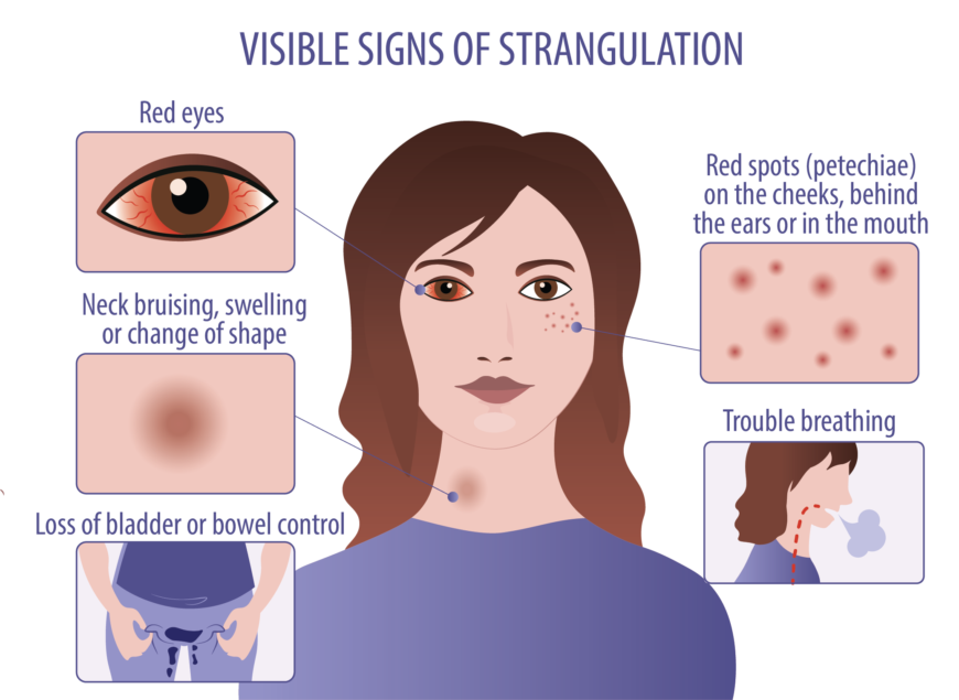 Strangulation - It Left No Marks